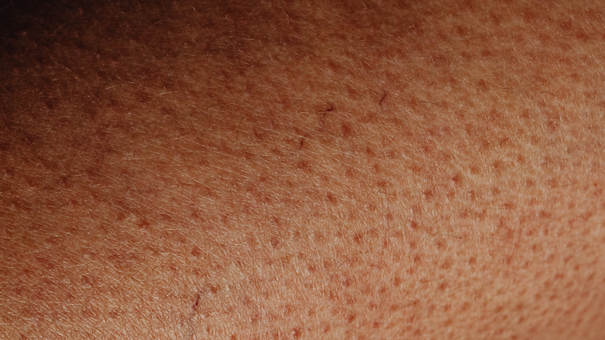 Classificação das Lesões de Pele: sinais que nunca devem ser ignorados ...